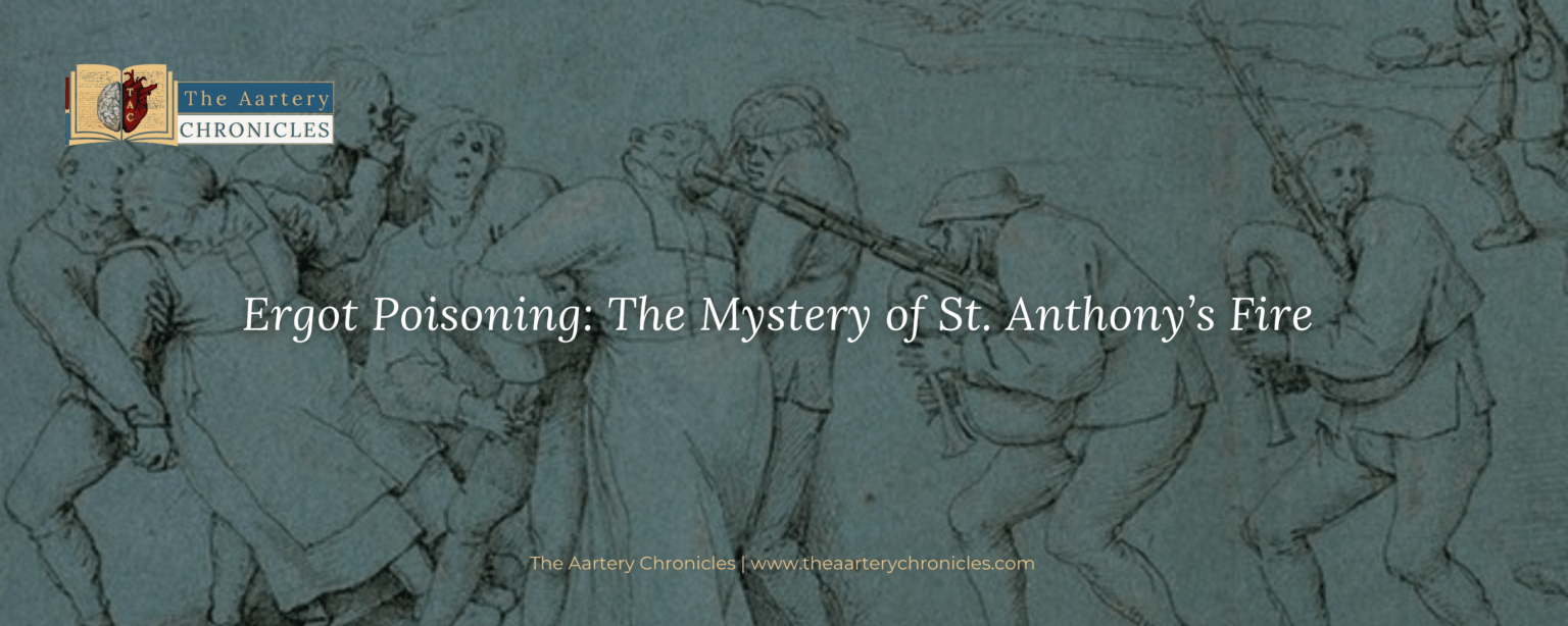 Ergot Poisoning And Ergotism: The Mystery Of St. Anthony’s Fire - The ...