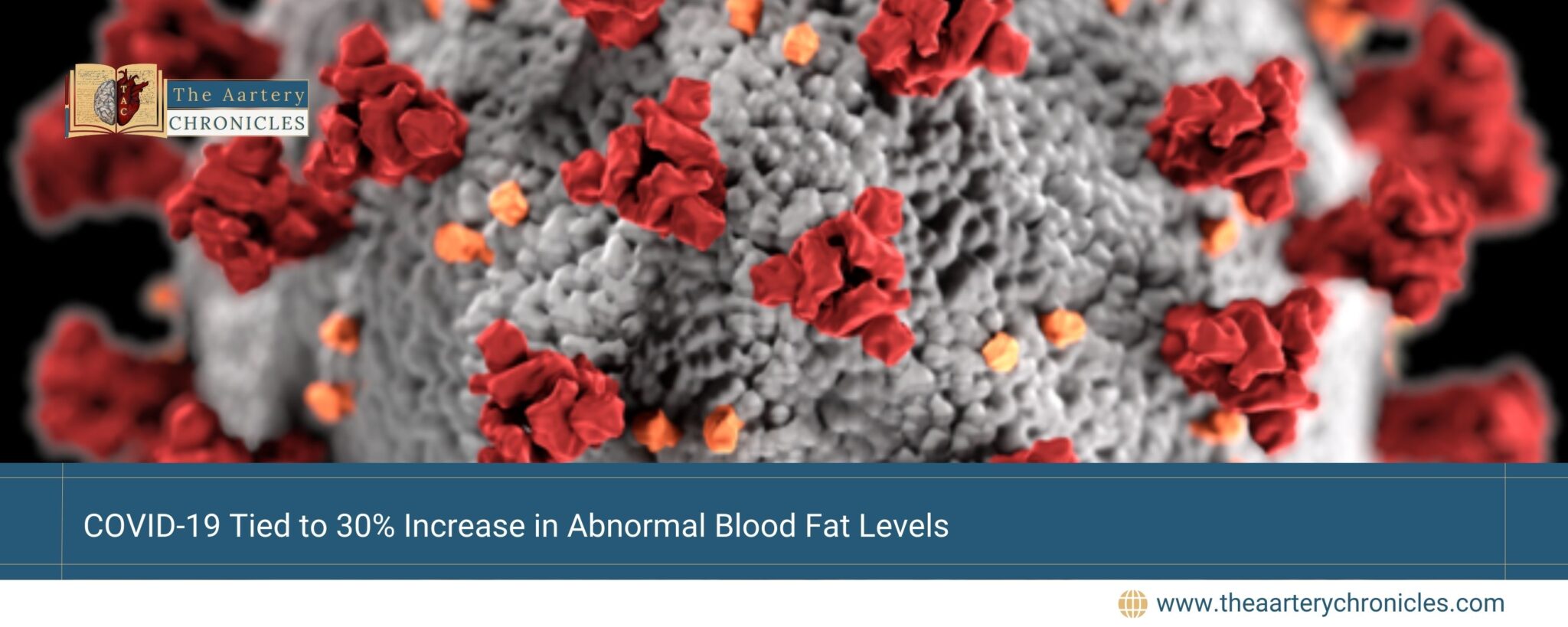 COVID-19 Tied to 30% Increase in Abnormal Blood Fat Levels