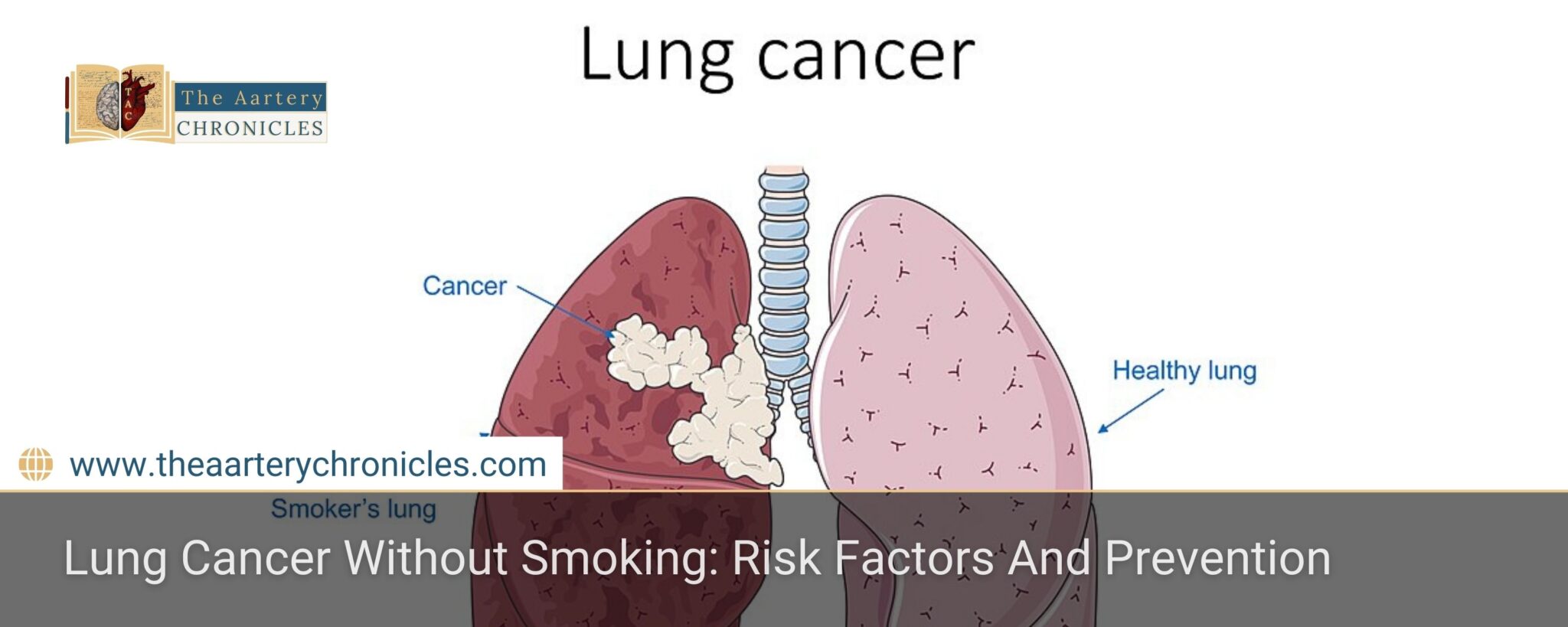 Can You Get Lung Cancer Without Smoking - SMARTCUSTOMESSAYS.COM