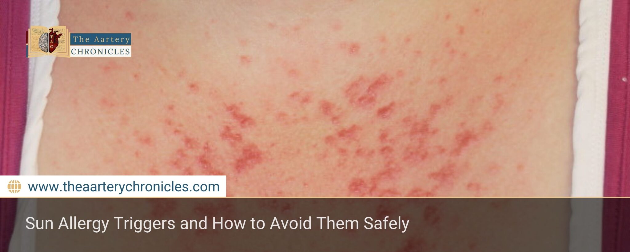 Sun Allergy Triggers and How to Avoid Them Safely