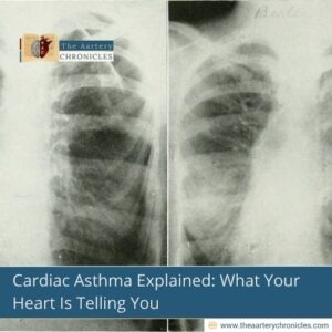 Cardiac Asthma Explained: What Your Heart Is Telling You