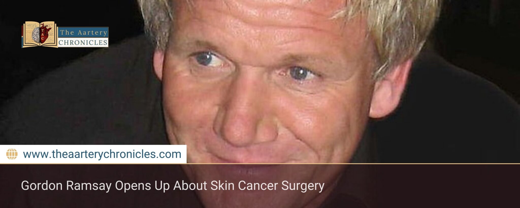 Gordon Ramsay Opens Up About Skin Cancer Surgery