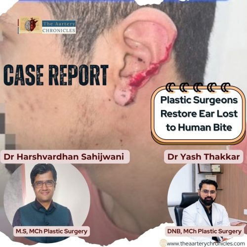 Remarkable Recovery After Ear Mutilation by Human Bite